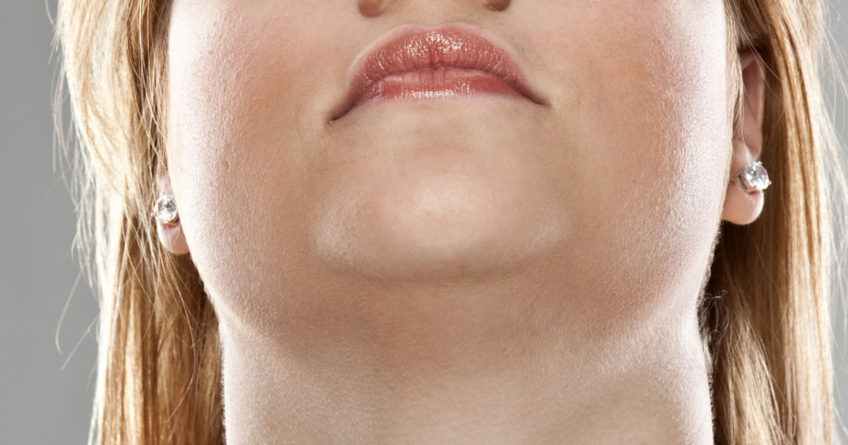 Doppelkinn weg in 3 Minuten